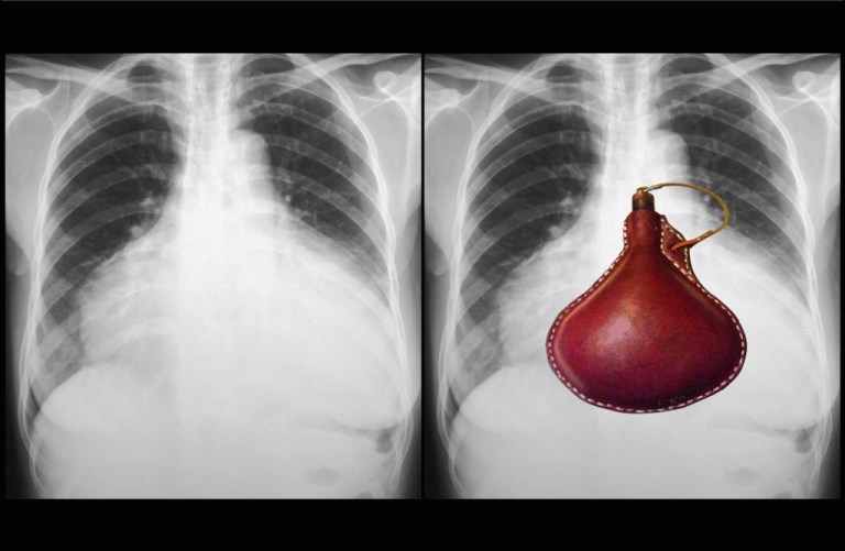 The anatomy of a heart, and a water bottle | doc w/ Pen